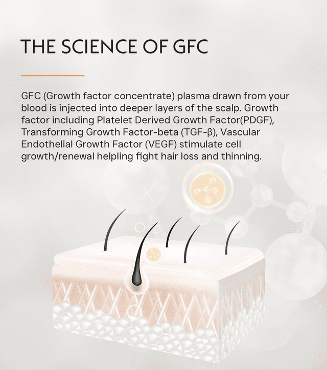 GFC Hair Treatment Cost for hair regrowth | Hair Fall Treatment| VLCC