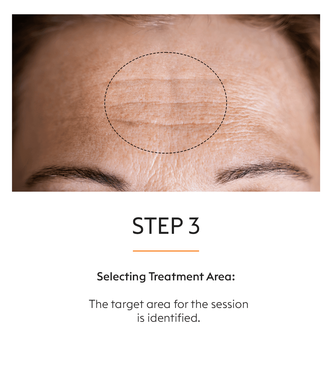 GFC Hair Treatment Cost for hair regrowth | Hair Fall Treatment| VLCC