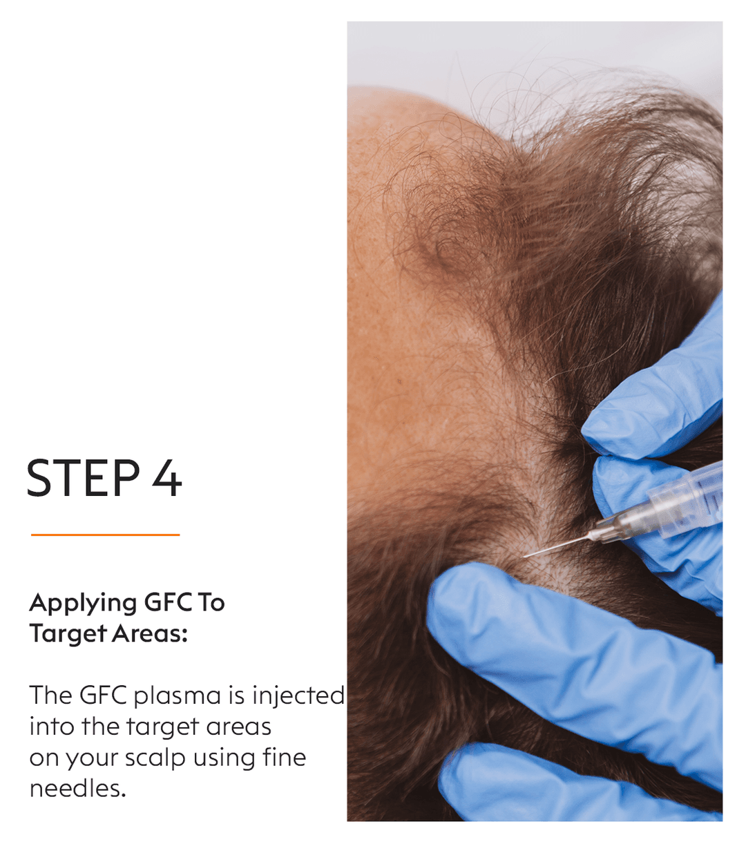 GFC Hair Treatment Cost for hair regrowth | Hair Fall Treatment| VLCC