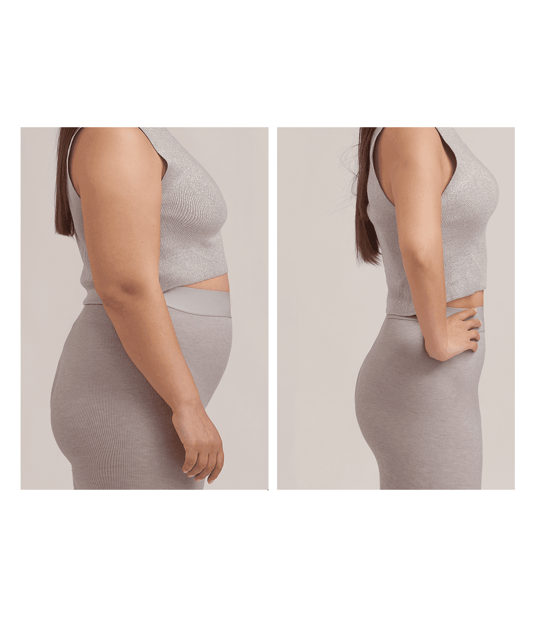 Weight Loss, Reduction, & Management Treatment Solutions|VLCC